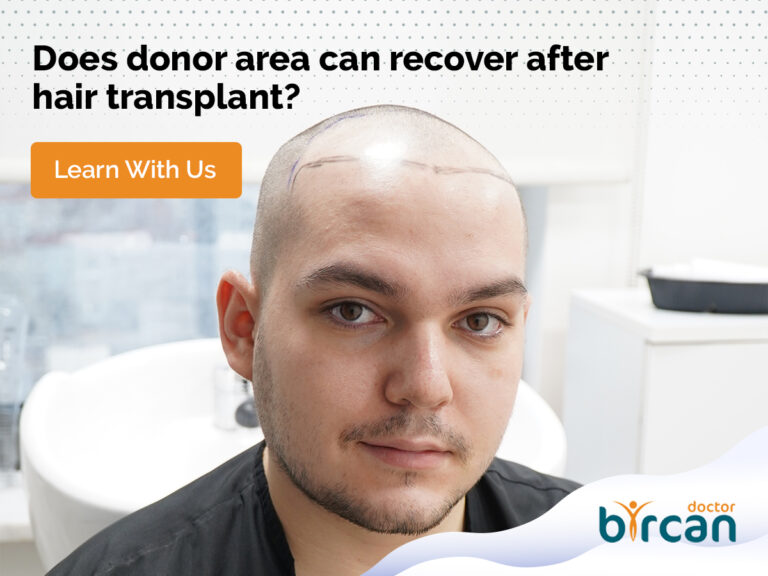 Does Donor Area Can Recover After Hair Transplant? » Dr. Gökhan Bircan